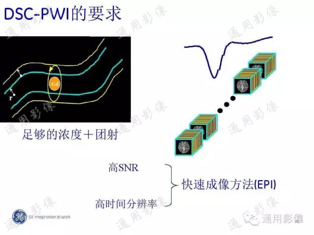 【PPT】PWI原理及临床应用 – 影像PPT