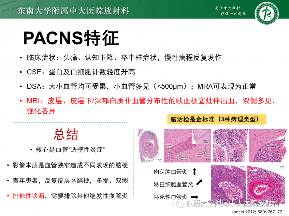 【PPT】原发性中枢神经系统血管炎（PACNS） VS 神经梅毒——脑皮层常见病变的诊断思路 – 影像PPT